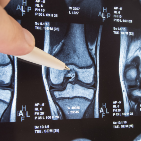 The Overlap Between an Orthopedic Specialist and a Rheumatologist ...